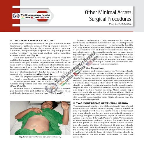 Other Minimal Access Surgical Procedures | PDF