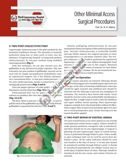Cricothyrotomy | PPT