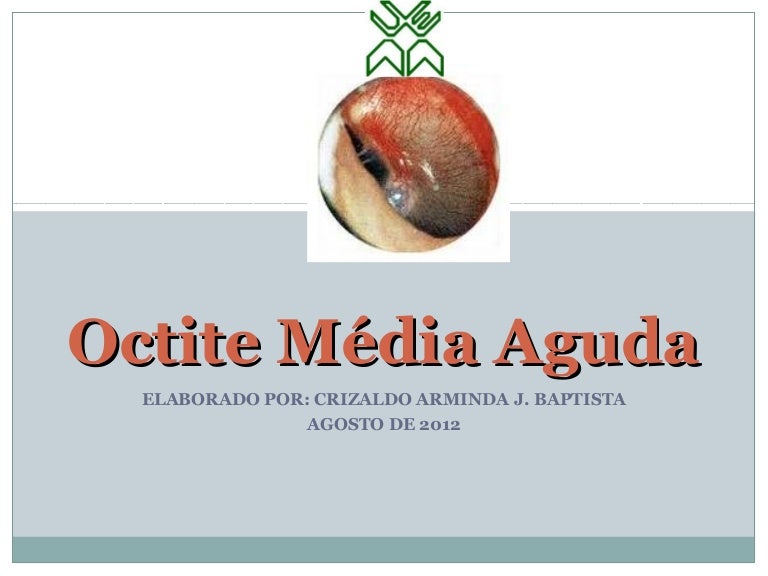 Otite media aguda