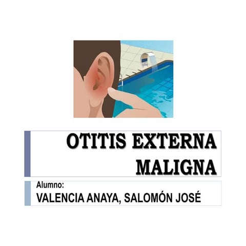 Otitis Externa Maligna Otitis Externa: Practice Essentials,