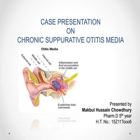 CASE PRESENTATION ON CHRONIC SUPPURATIVE OTITIS MEDIA | PPTX