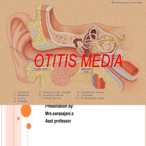 Otitis media | PPTX