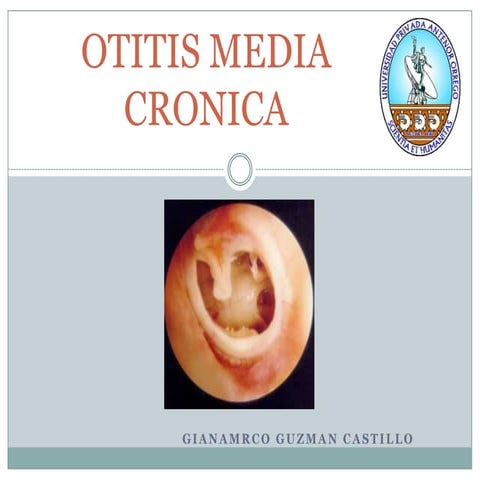 Otitis Media Crónica
