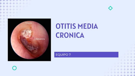Otitis Media Crónica