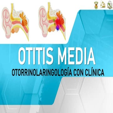 Otitis media aguda, crónica y serosa | PPTX