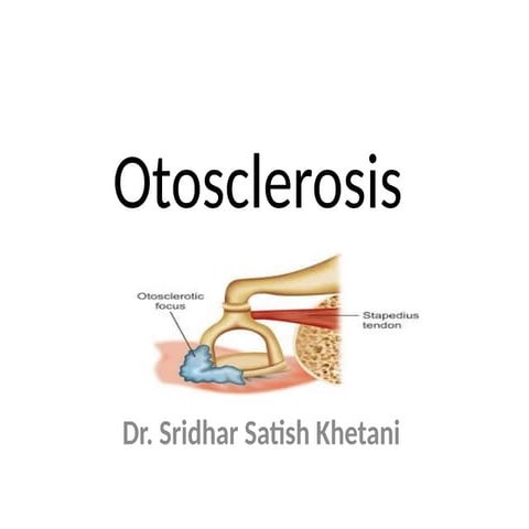 otosclerosis cfwerwrrr2r2r3egrgrgeg.pptx