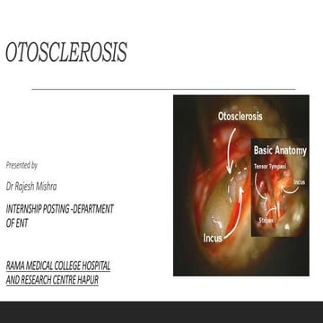 Otosclerosis by Dr. Rajesh Mishra | PPTX