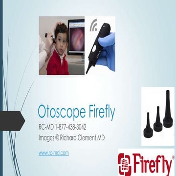 Video Otoscopio Firefly | PPTX | Ear, Nose and Throat Conditions ...