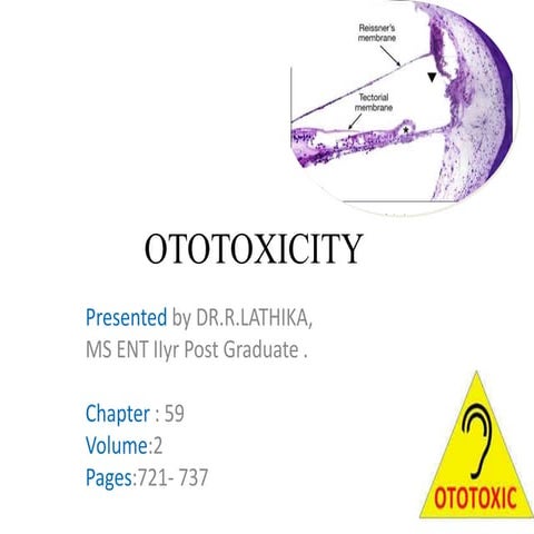 Ototoxicity | PPTX
