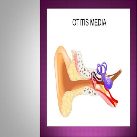 Ottis media n.pptx otitis media infection | PPTX