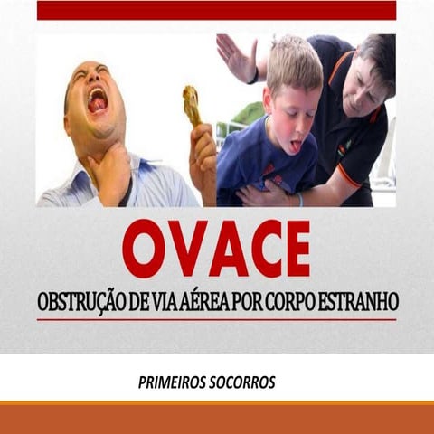 Ovace | PPTX
