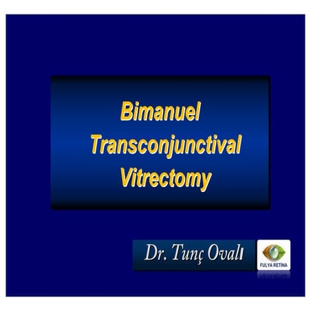 Ovali bimanual transconjunctional virectomy | PDF