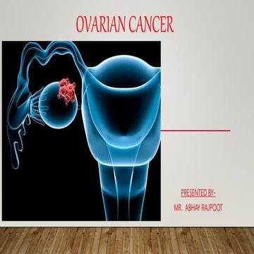 Ovarian Cancer | PPTX
