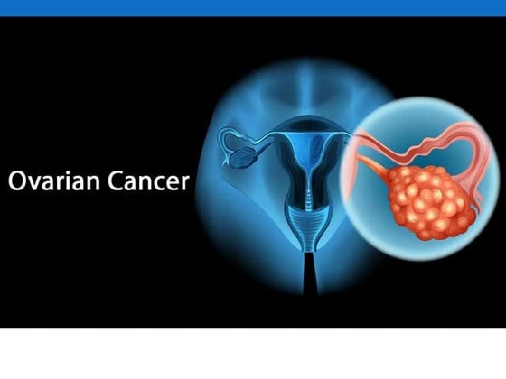 12. Uterine Cancer | PPT