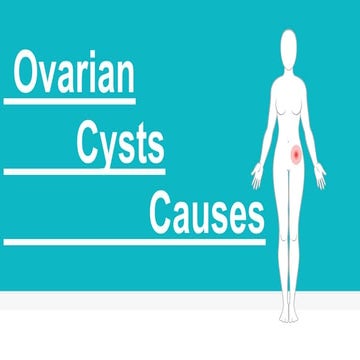 Ovarian Cyst Causes | Ovarian Cyst Treatment |Ovarian Cyst Pain | PPTX