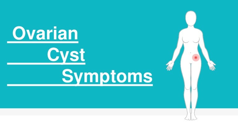 Ovarian Cyst Symptoms| Symptoms of Ovarian Cyst
