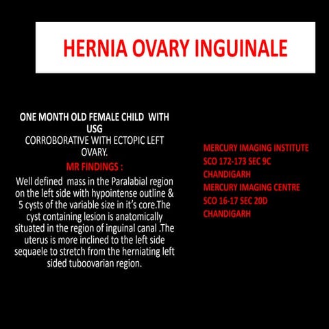 Ovarian hernia inguinale.pptx