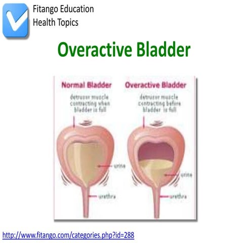Overactive Bladder | PPTX