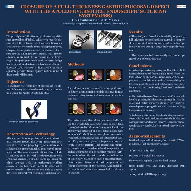 Overstitch - a new endoluminal surgery system | PDF