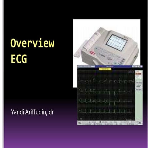 Overview ecg | PPT