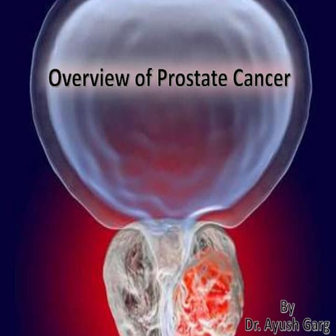 CES2018-01: Cáncer de próstata | PPTX