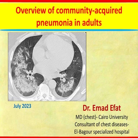 Overview of community-acquired pneumonia in adults.pdf