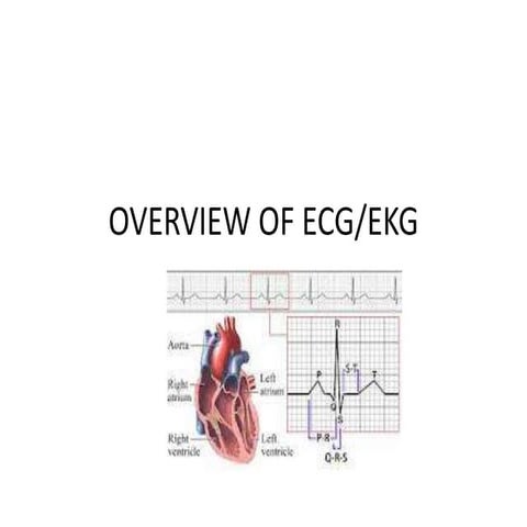 Overview of ecg part 1 | PPTX | Heart and Cardiovascular Diseases ...