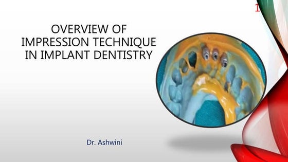 Impression techniques in implants | PPT