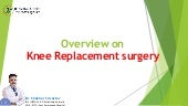 Total Knee Replacement | PPTX