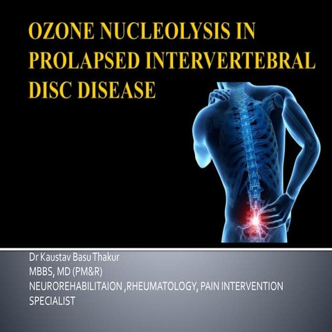 Ozone nucleolysis in prolapsed intervertebral disc disease | PPTX