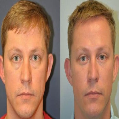 Dr. Alton Ingram MD | PPT