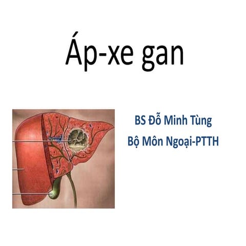 Áp-xe gan.ppt
