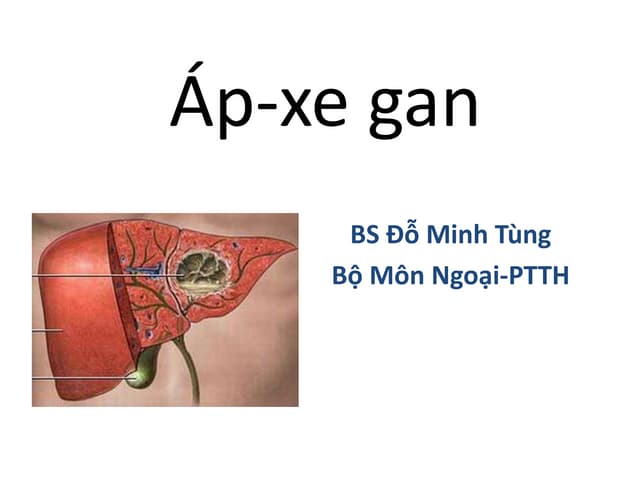 Áp-xe gan | PDF