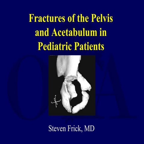 P07 pediatric pelvis, aceta | PPT
