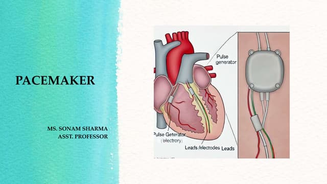 Pacemaker powerpoint presentation med surg | PPTX