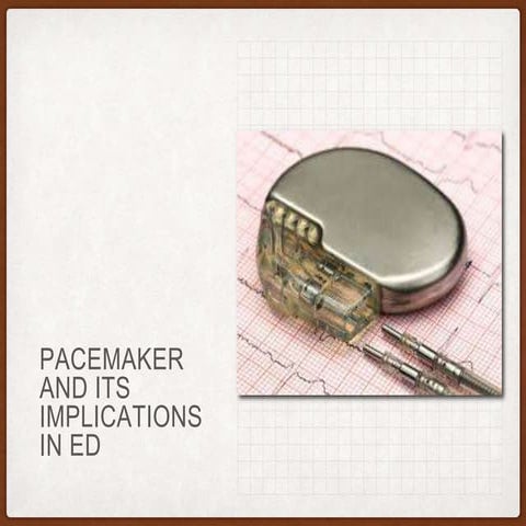 Cardiac Pacemakers - Basics | PPTX