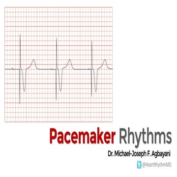 Pacemaker | PPT