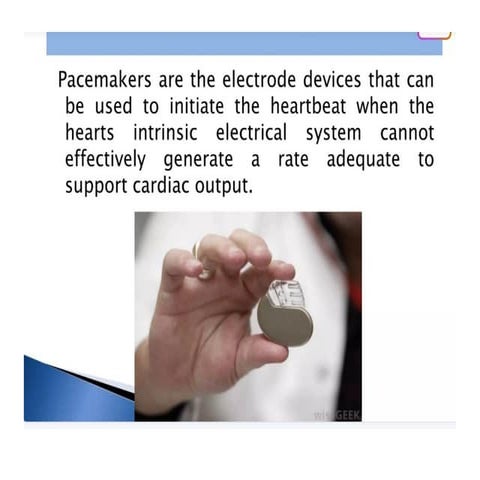 Pacemaker_Presentation .pptx