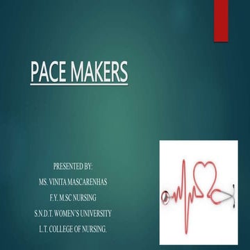 Pace makers | PPTX