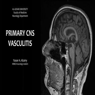 Primary Cns Vasculitis Ppt