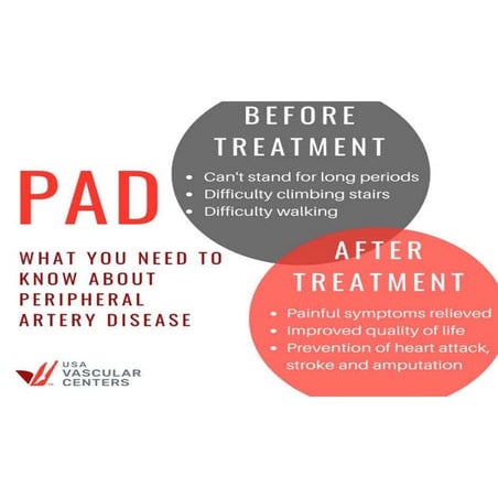 Before and After: Transforming Lives through PAD Treatment | PDF ...