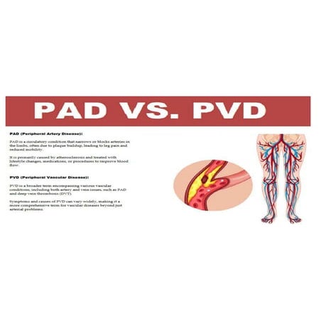 Understanding the Differences Between PAD vs. PVD | PDF