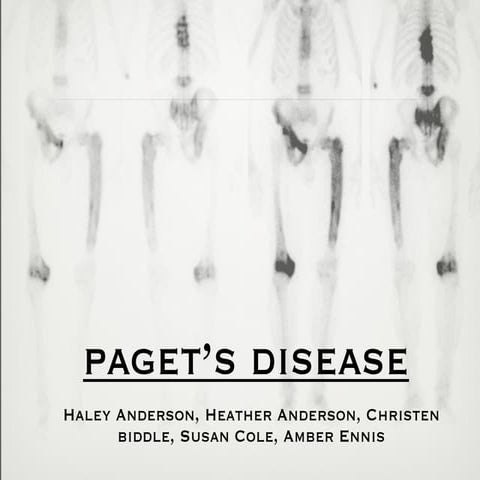 Common Referred Pain Patterns – Low Back | PDF