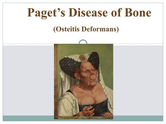 Bone remodelling and types of bone | DOCX | Bone and Joint Conditions ...