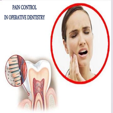 Pain control in Dentistry | PPTX