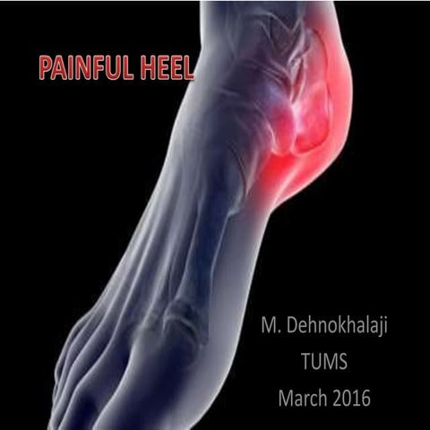 Common Referred Pain Patterns – Low Back | PDF