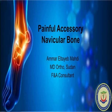 painfull accessory navicular bone(1).pptx