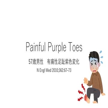 Painful purple toes | PPT