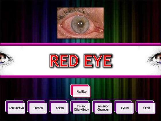 Disorders of the eye | PPTX