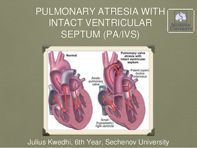 PA/IVS - Dr. Julius King Kwedhi